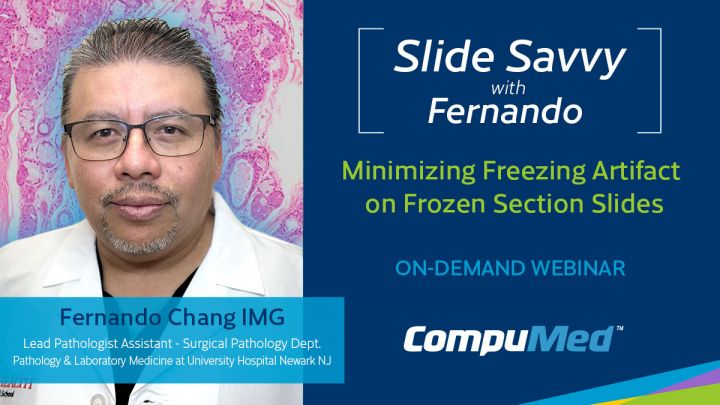 Slide Savvy - Minimizing Freezing Artifact on Frozen Section Slides
